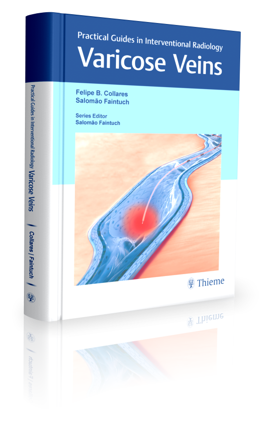 Varicose Veins Practical Guides In Interventional Radiology