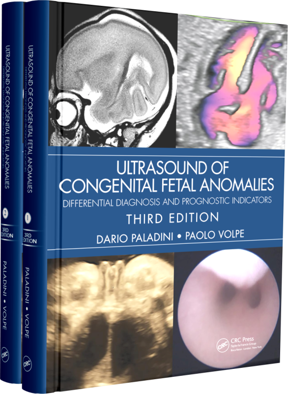 Ultrasound of Congenital Fetal Anomalies: Differential Diagnosis and Prognostic Indicators 3rd ...