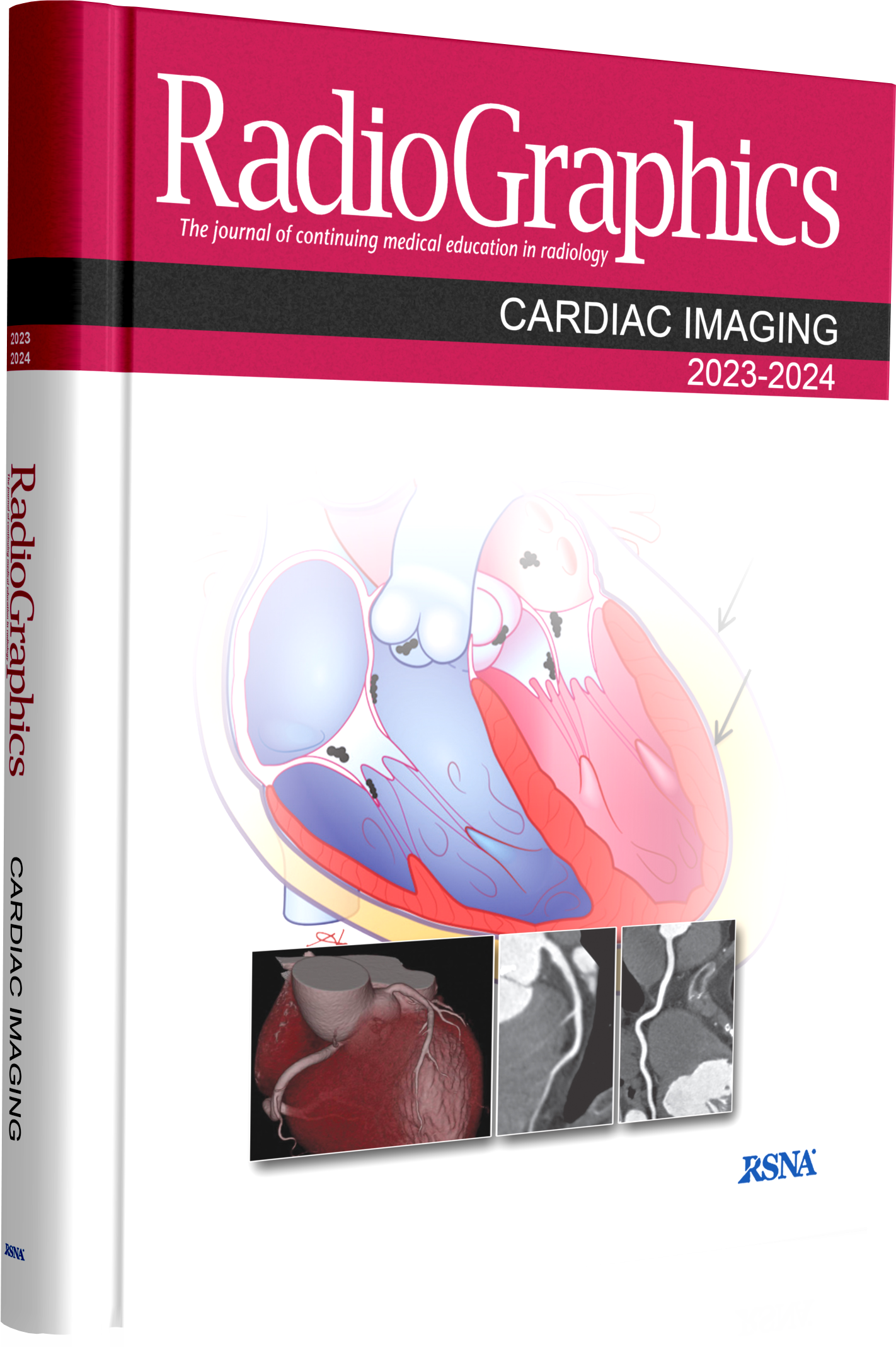 Radiographics: Cardiac Imaging 2023-2024 - انتشارات سالکان