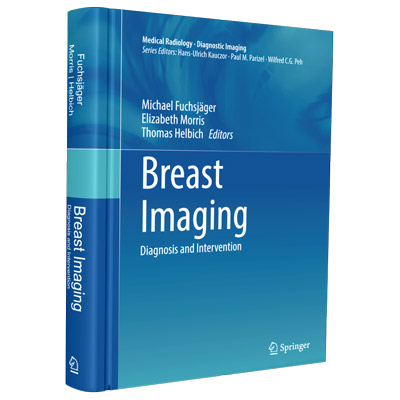 Breast Imaging: Diagnosis and Intervention - انتشارات سالکان