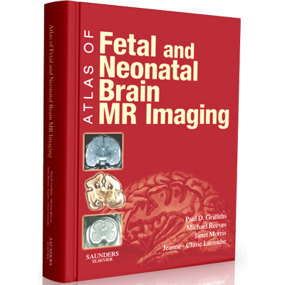 The Atlas of Fetal and Neonatal Brain MR Imaging - انتشارات سالکان