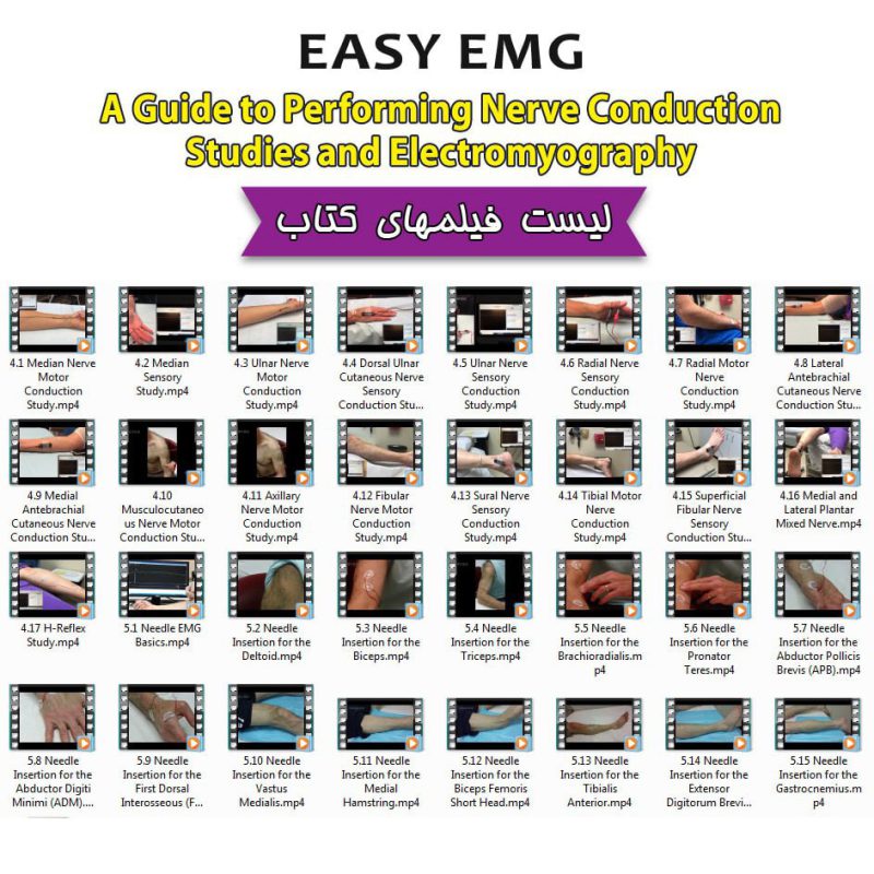 Easy EMG: A Guide to Performing Nerve Conduction Studies and ...
