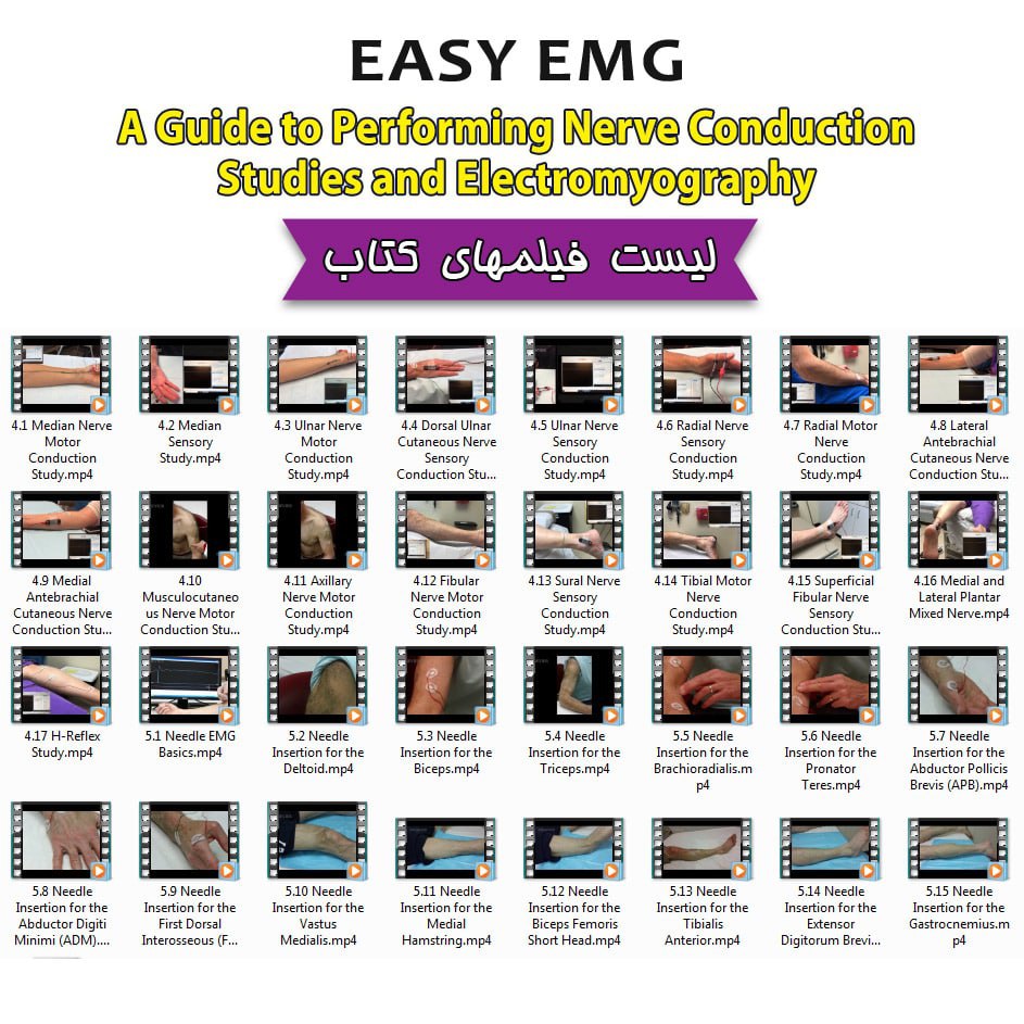 Easy EMG: A Guide to Performing Nerve Conduction Studies and ...