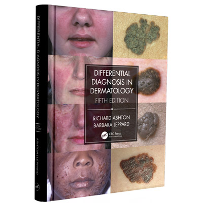 Differential Diagnosis in Dermatology - انتشارات سالکان
