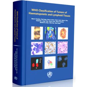 WHO Classification of Tumours of Haematopoietic and Lymphoid Tissues ...