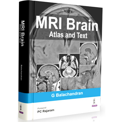 MRI Brain: Atlas and Text - انتشارات سالکان