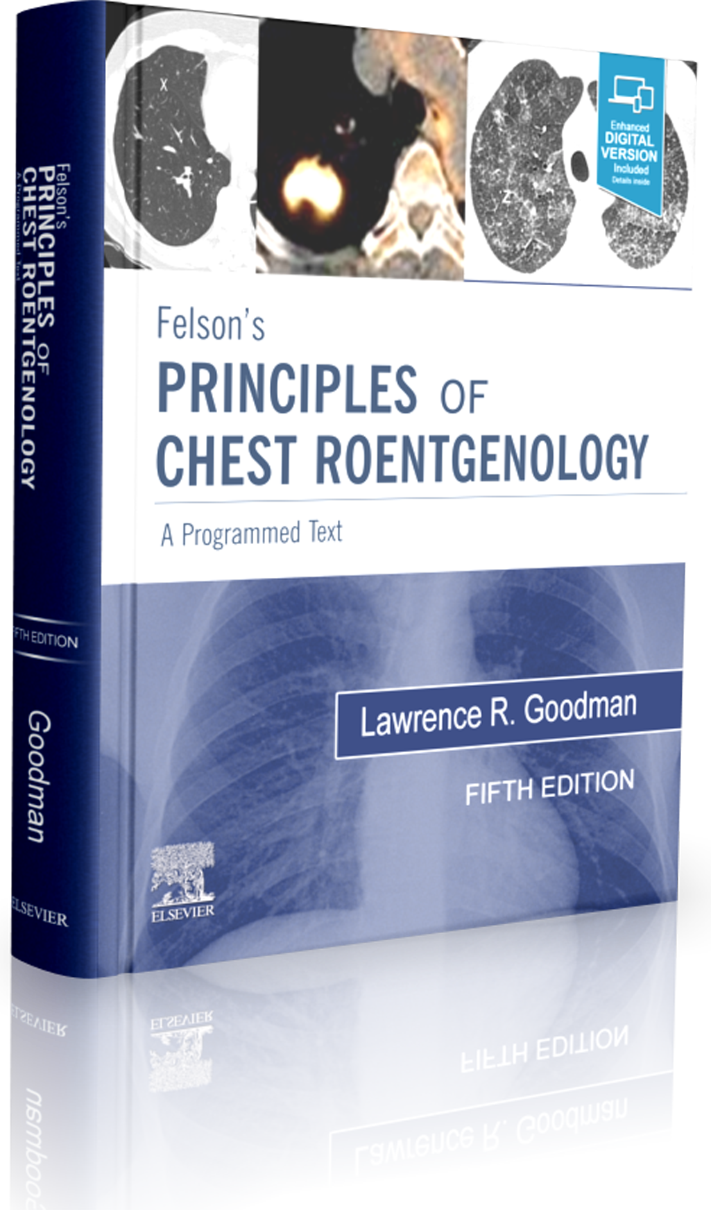 Felson's Principles of Chest Roentgenology, A Programmed Text: A ...