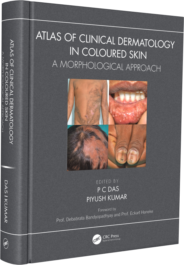 Atlas of Clinical Dermatology in Coloured Skin: A Morphological Approach - انتشارات سالکان