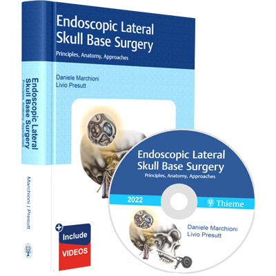 Endoscopic Lateral Skull Base Surgery: Principles, Anatomy, Approaches - انتشارات سالکان