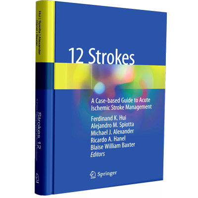 12 Strokes A Case-based Guide to Acute Ischemic Stroke Management ...