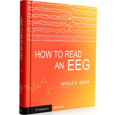 How to Read an EEG - انتشارات سالکان