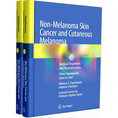 Non-Melanoma Skin Cancer and Cutaneous Melanoma Surgical Treatment and ...