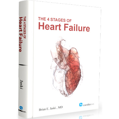The 4 Stages of Heart Failure - انتشارات سالکان