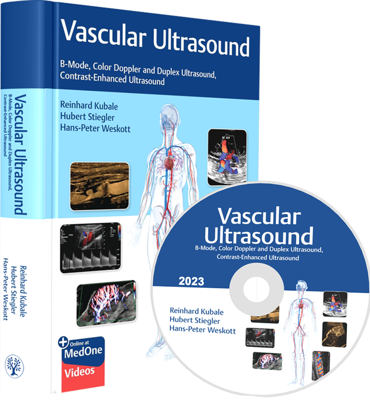 Vascular Ultrasound B-Mode, Color Doppler and Duplex Ultrasound, Contrast-Enhanced Ultrasound ...