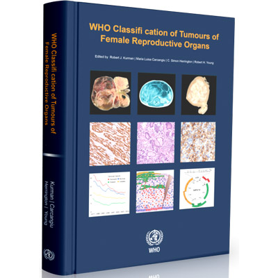WHO Classification of Tumours of the Female Reproductive Organs ...