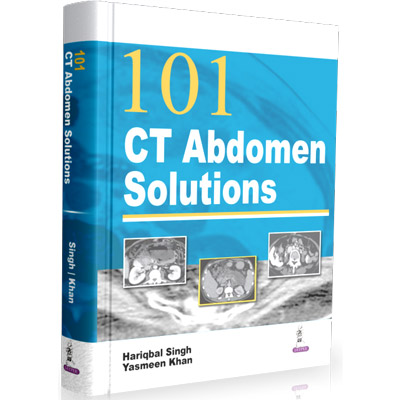 101 CT Abdomen Solutions - انتشارات سالکان