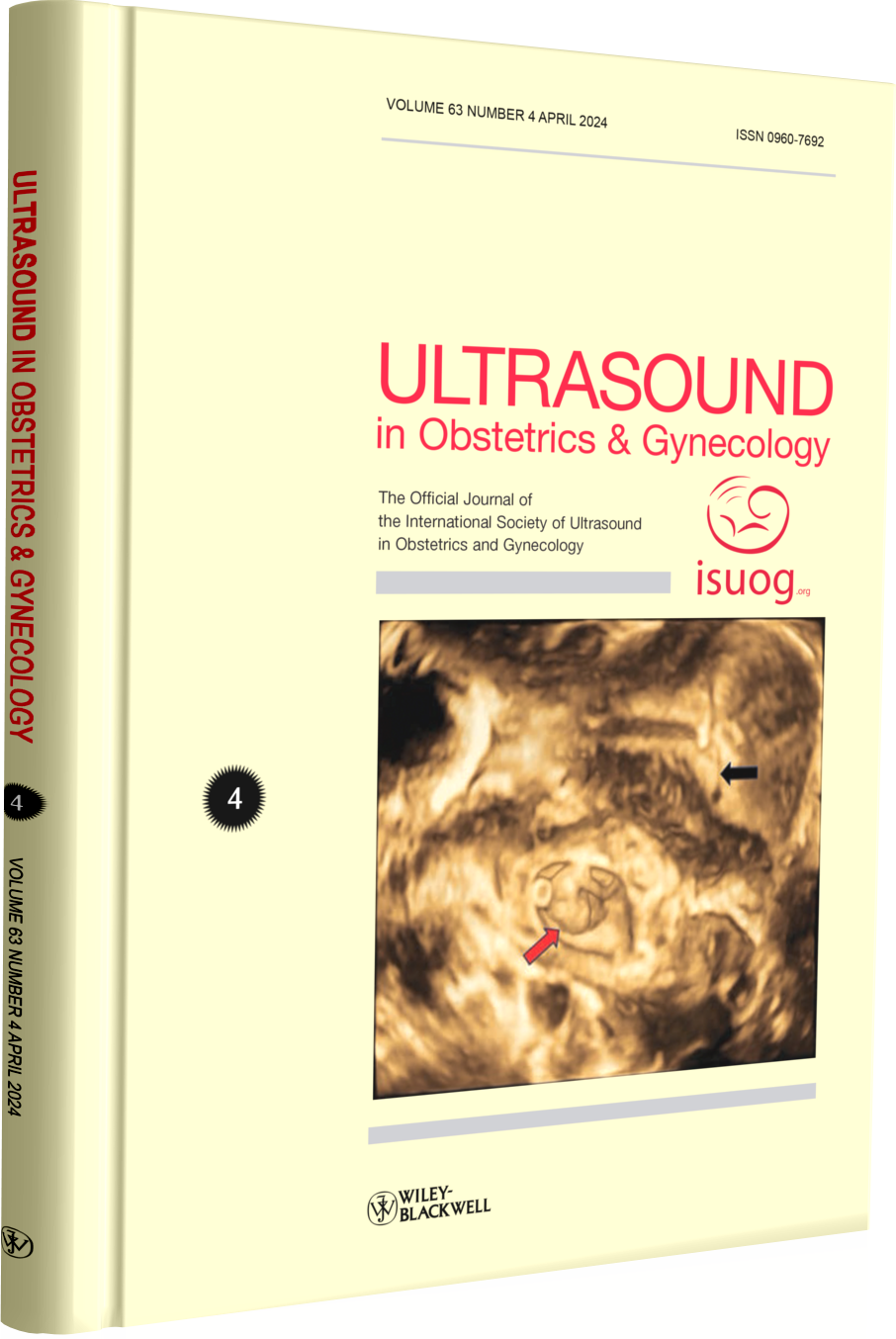Ultrasound in Obstetrics & Gynecology: isuog 2024 (Vol 63 - N4 ...