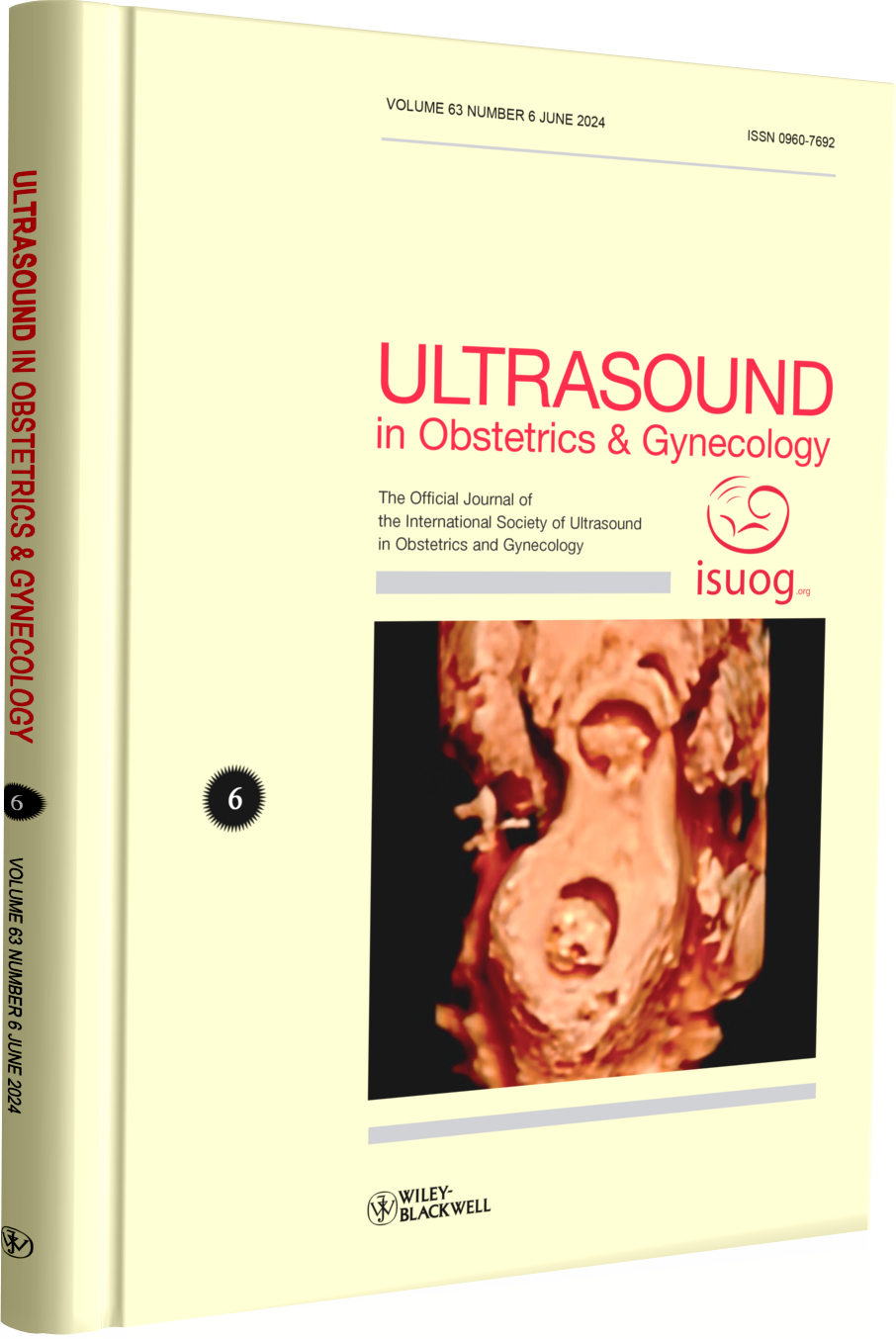 Ultrasound in Obstetrics & Gynecology: isuog 2024 (Vol 63 - N6 ...