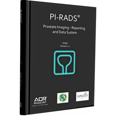 PI-RADS Prostate Imaging - Reporting and Data System (Version 2.1) - انتشارات سالکان