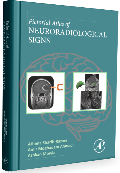 Pictorial Atlas of Neuroradiological Signs - انتشارات سالکان