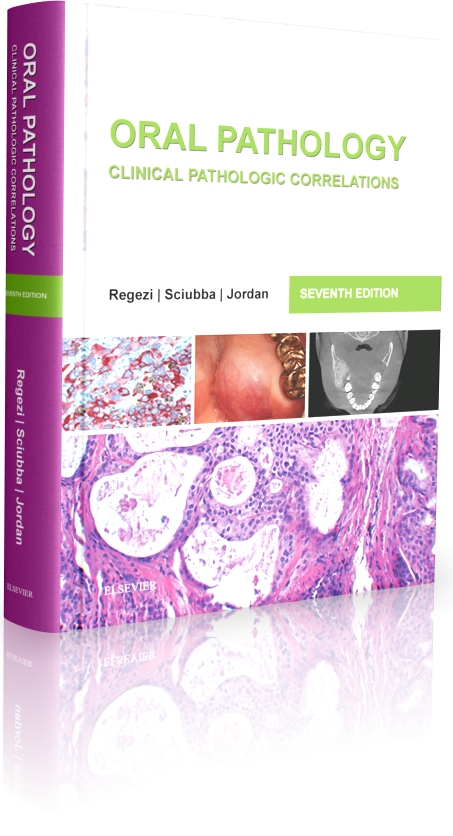 Oral Pathology: Clinical Pathologic Correlations 7th Edition - انتشارات ...